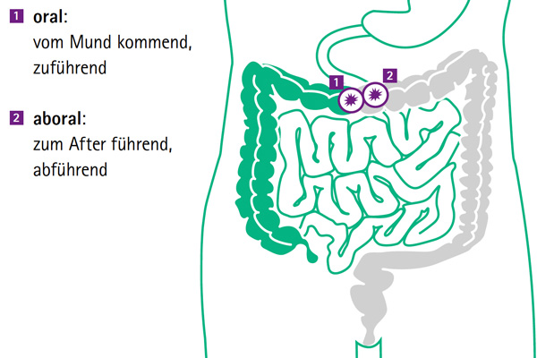 Colostoma Versus Ileostoma Having A Stoma Cancer Council Victoria